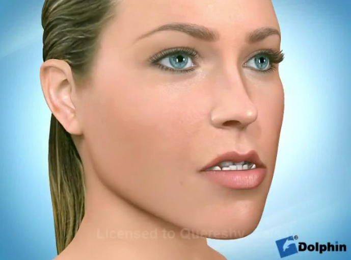 Orthognathic Surgery Medina | Corrective Jaw Surgery Cleveland